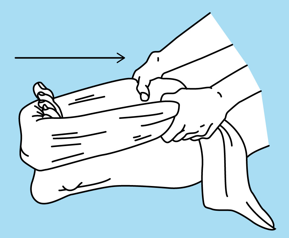 Ziekte van Sever: symptomen, oorzaken en behandeling