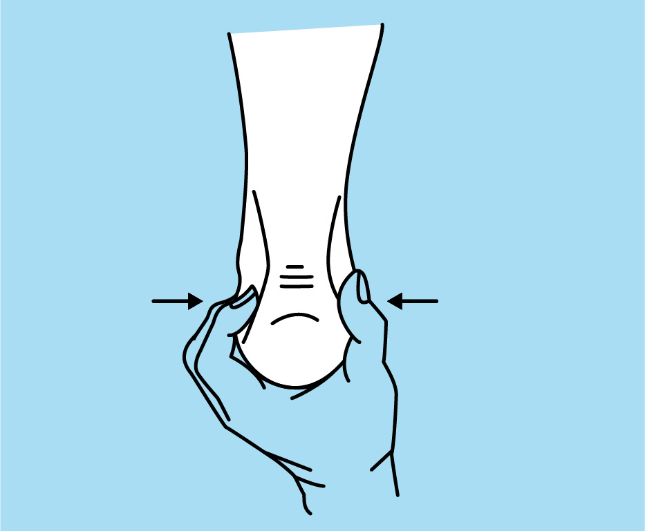 Ziekte van Sever: symptomen, oorzaken en behandeling