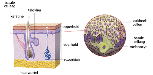 De laatste decennia grijpt huidkanker razendsnel om zich heen.