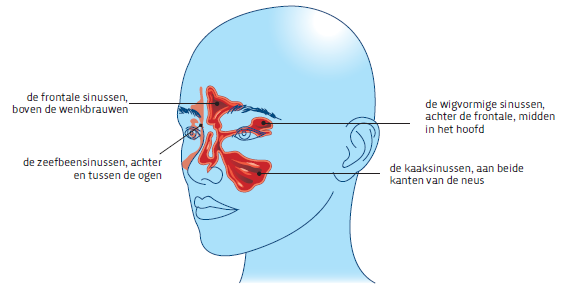 Sinusitis
